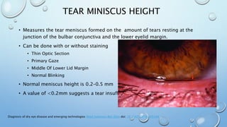 Diagnosis & management of dry eye | PPT
