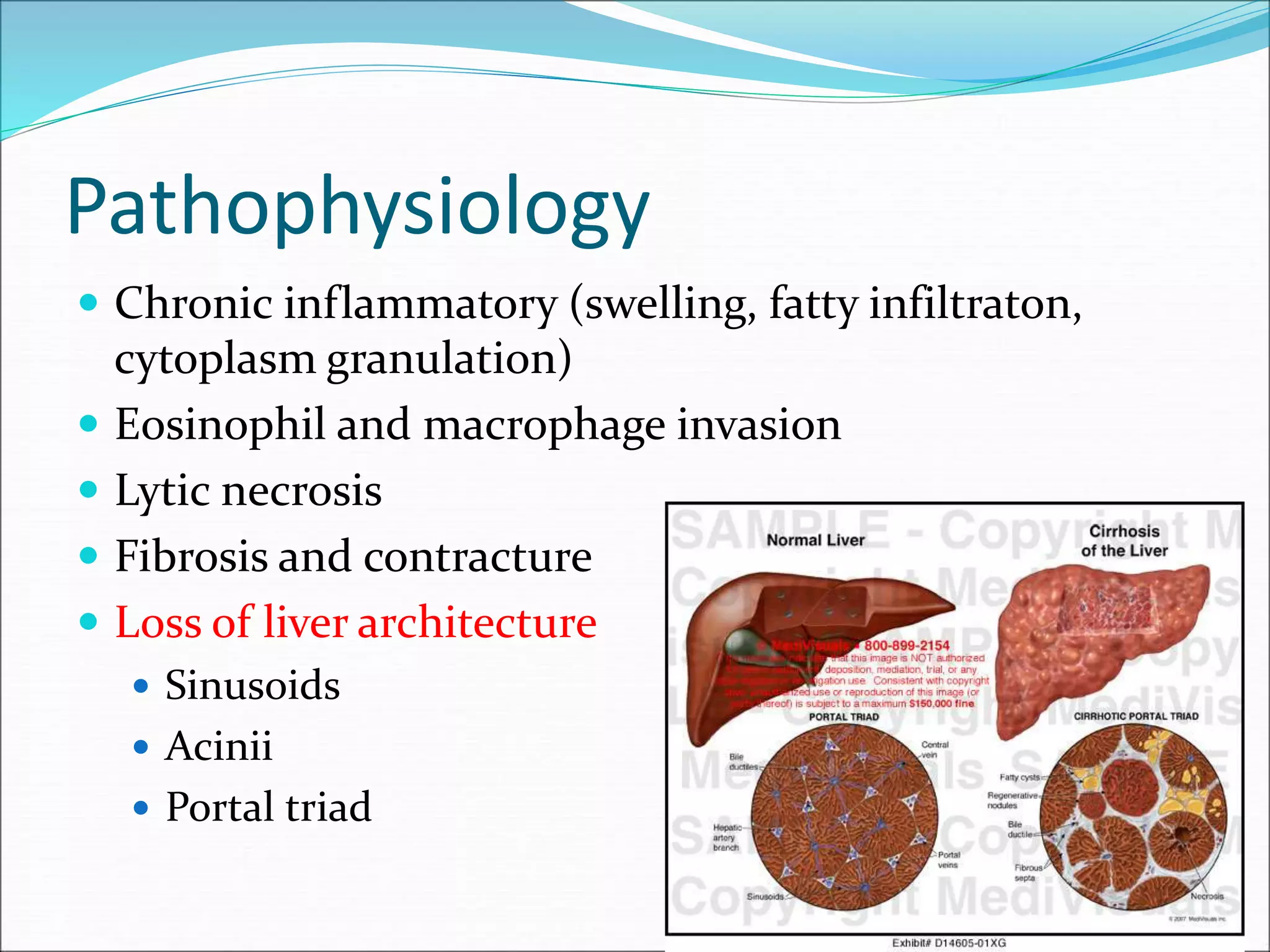 Diagnosis & Management of Chronic Liver Disease.ppt