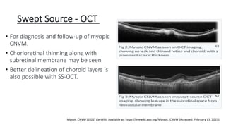 Diagnosis Myopic Neovascularization.pptx