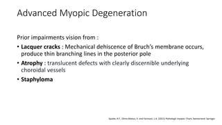 Diagnosis Myopic Neovascularization.pptx