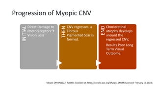 Diagnosis Myopic Neovascularization.pptx
