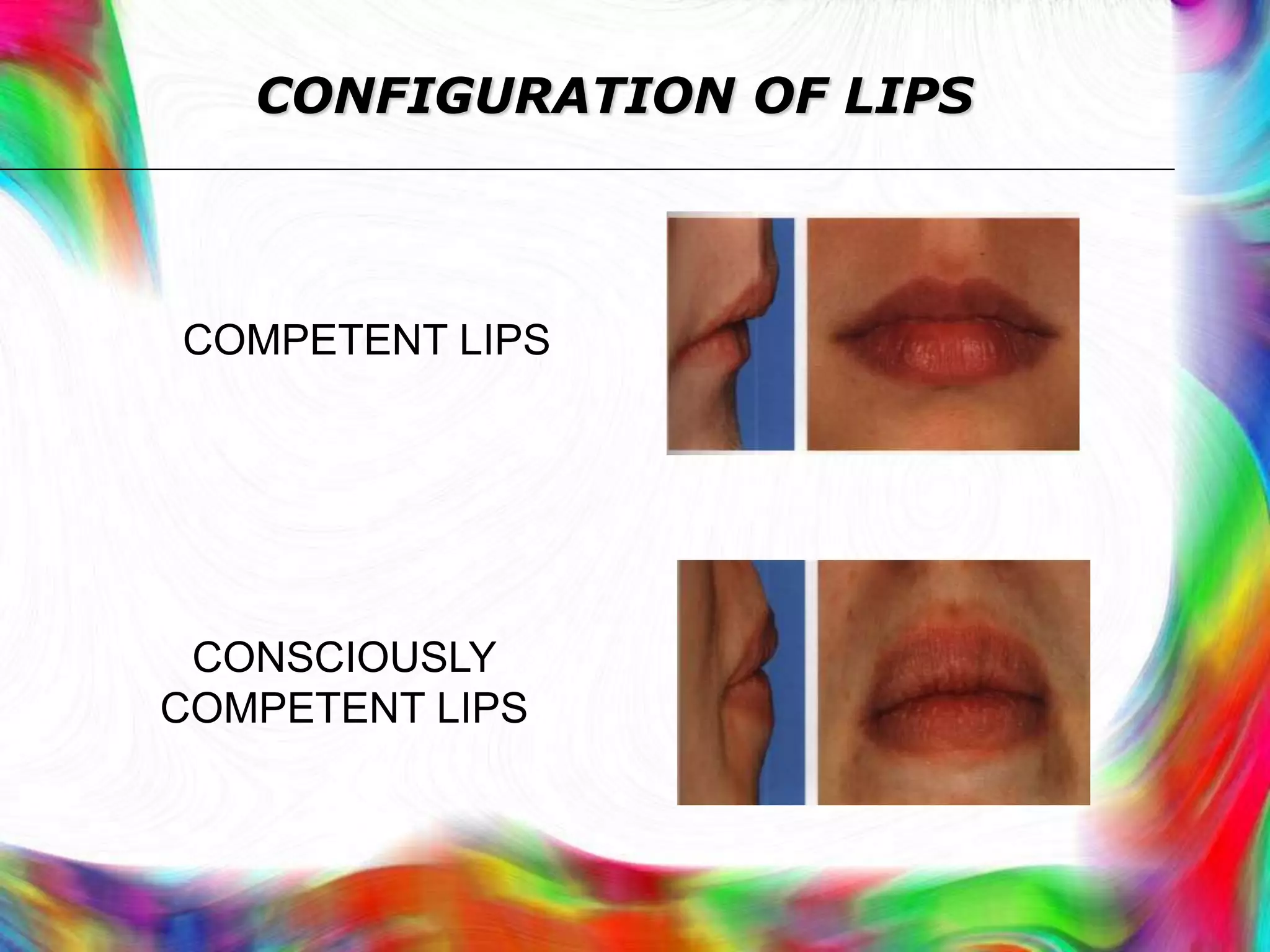 DIAGNOSIS IN ORTHODONTICS O.ppt