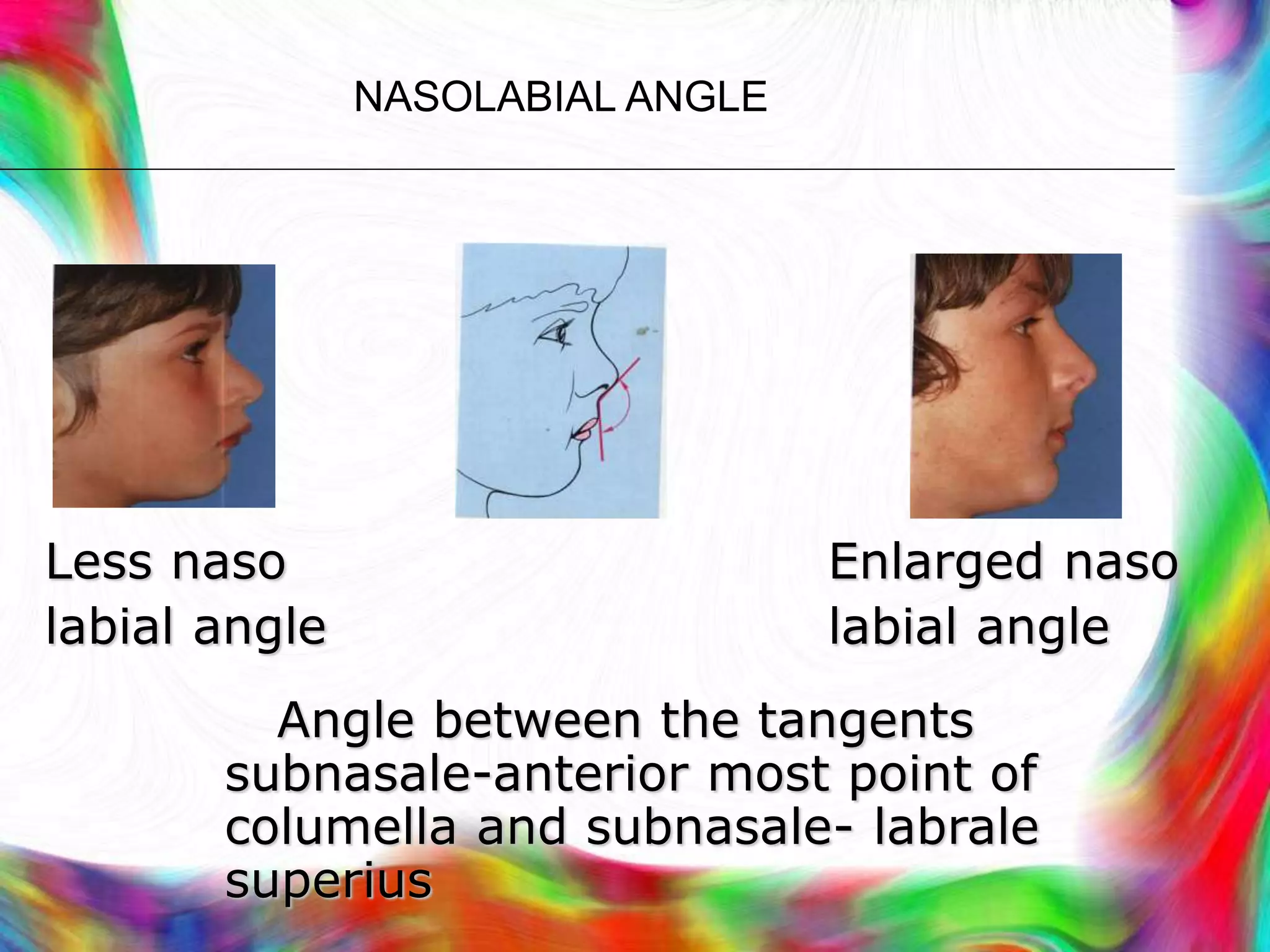DIAGNOSIS IN ORTHODONTICS O.ppt