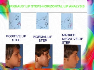 DIAGNOSIS IN ORTHODONTICS O.ppt