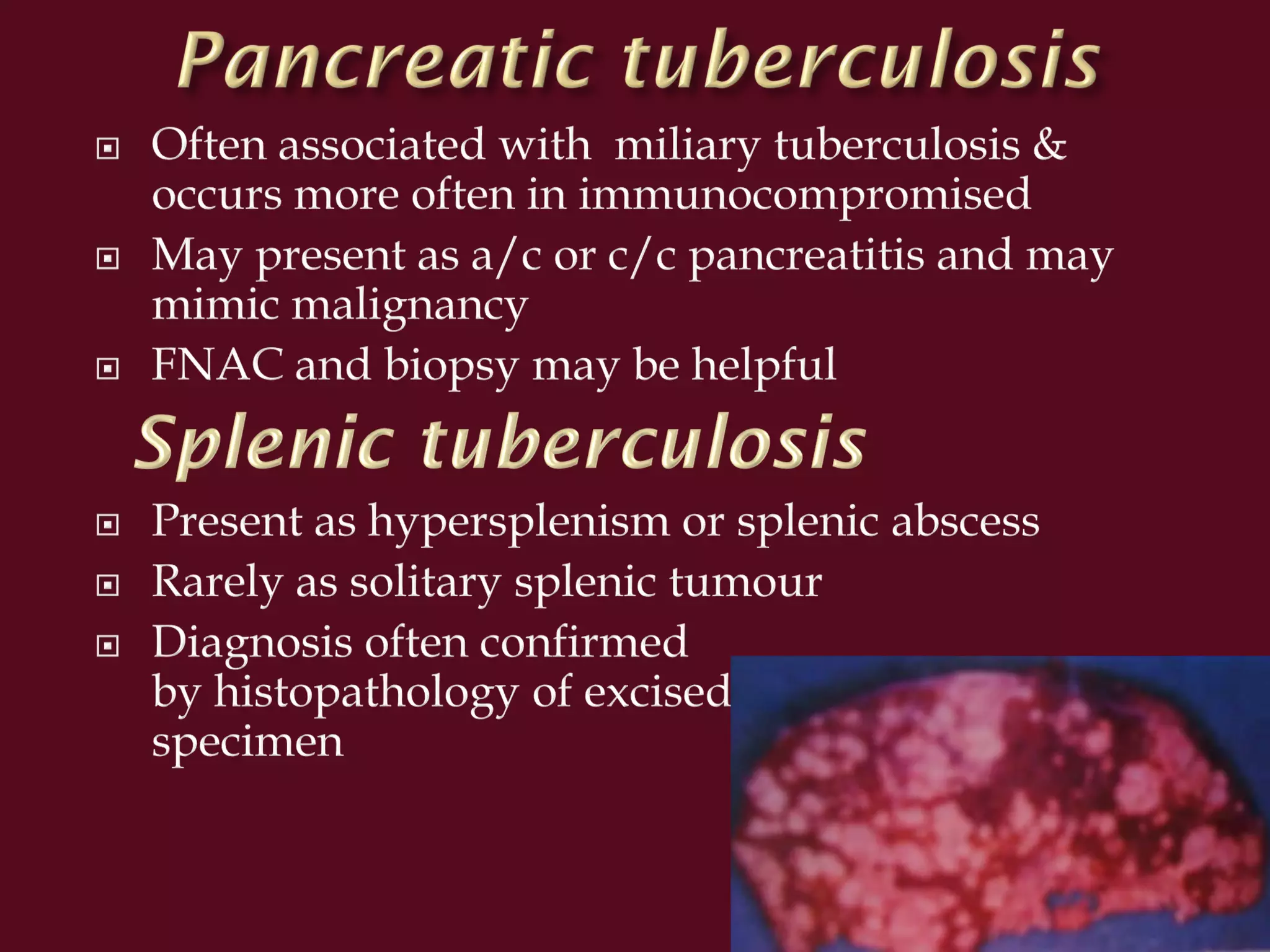 Diagnosis of abdominal tuberculosis | PDF | Digestive Disorders ...