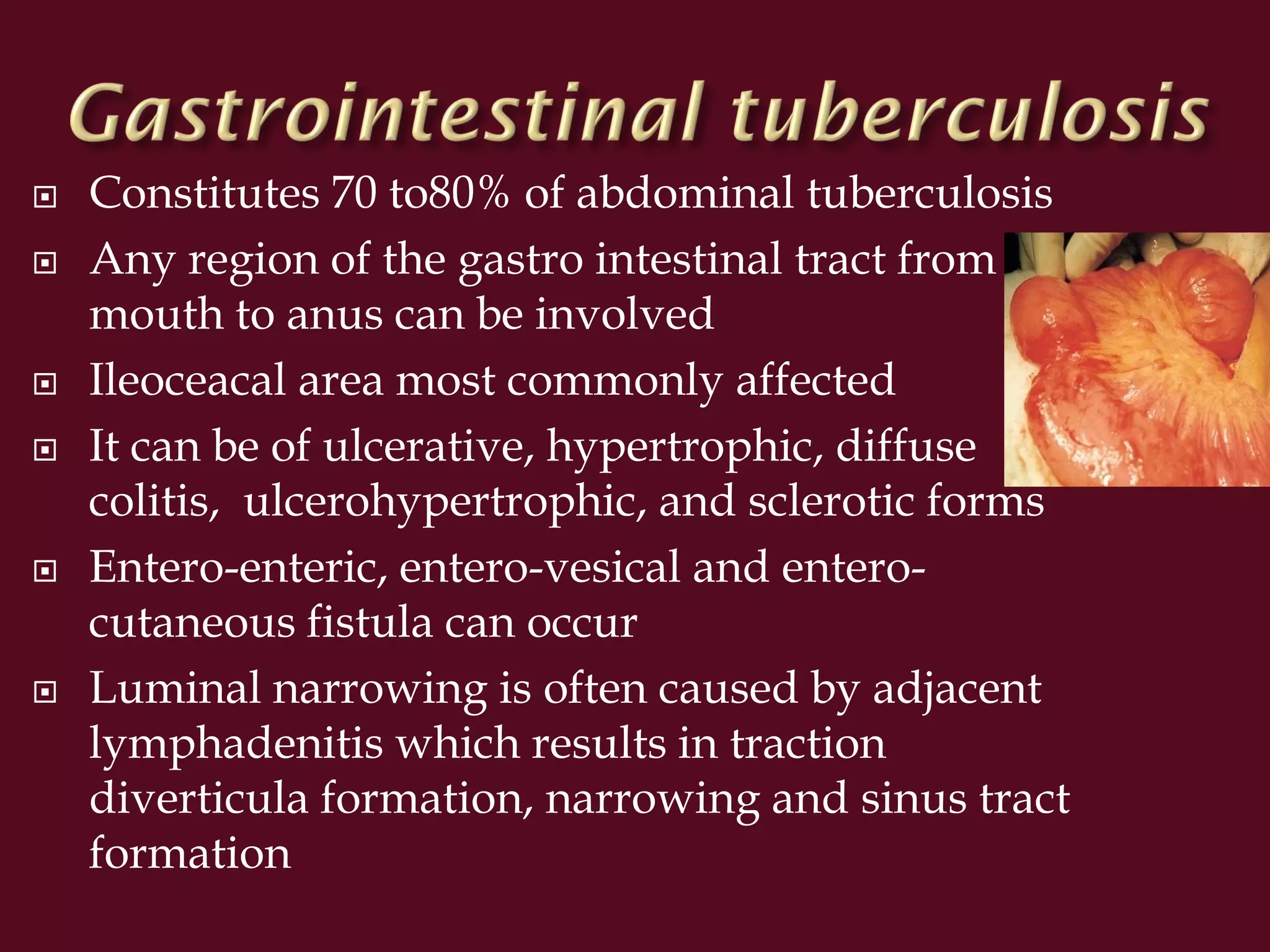 Diagnosis of abdominal tuberculosis | PPT