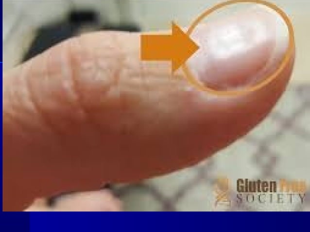 ANEMIA IN PEDIATRICS 2019 | PPT