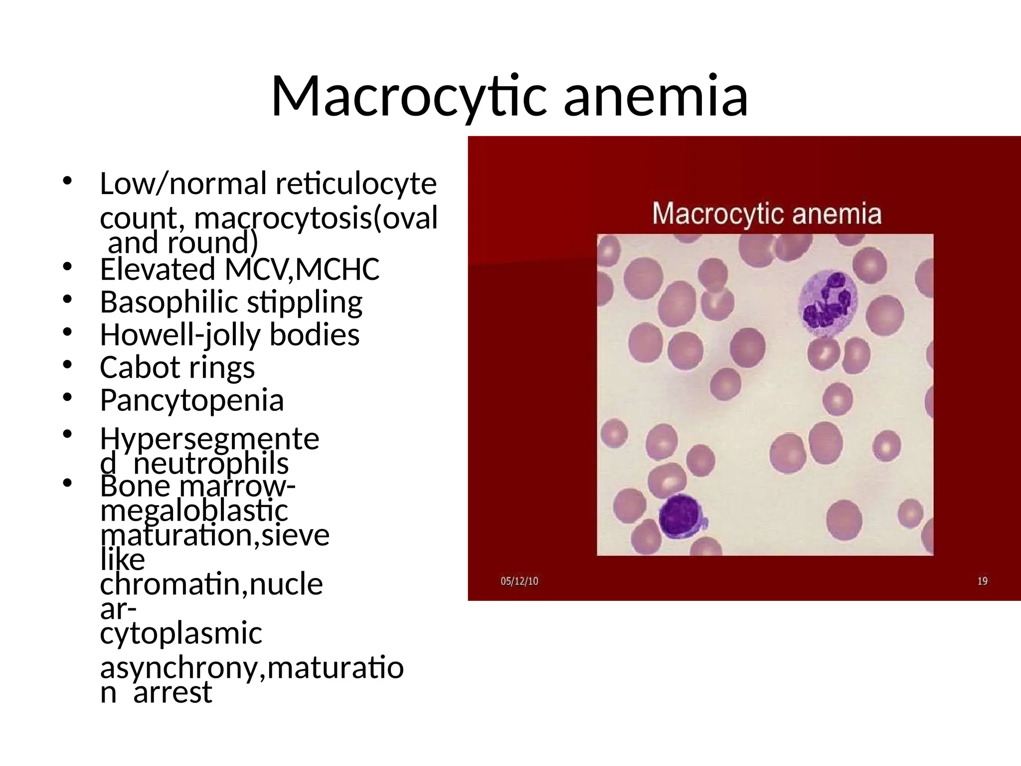 Diagnosis of anemia.................pptx