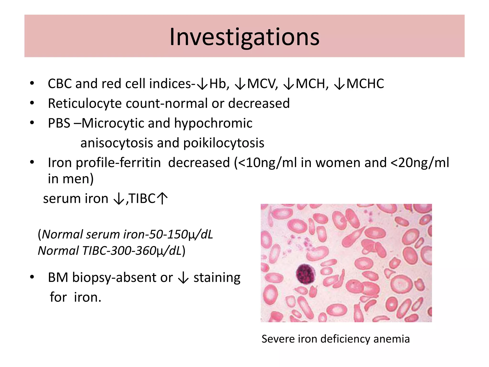 Diagnosis of Anemia | PPTX