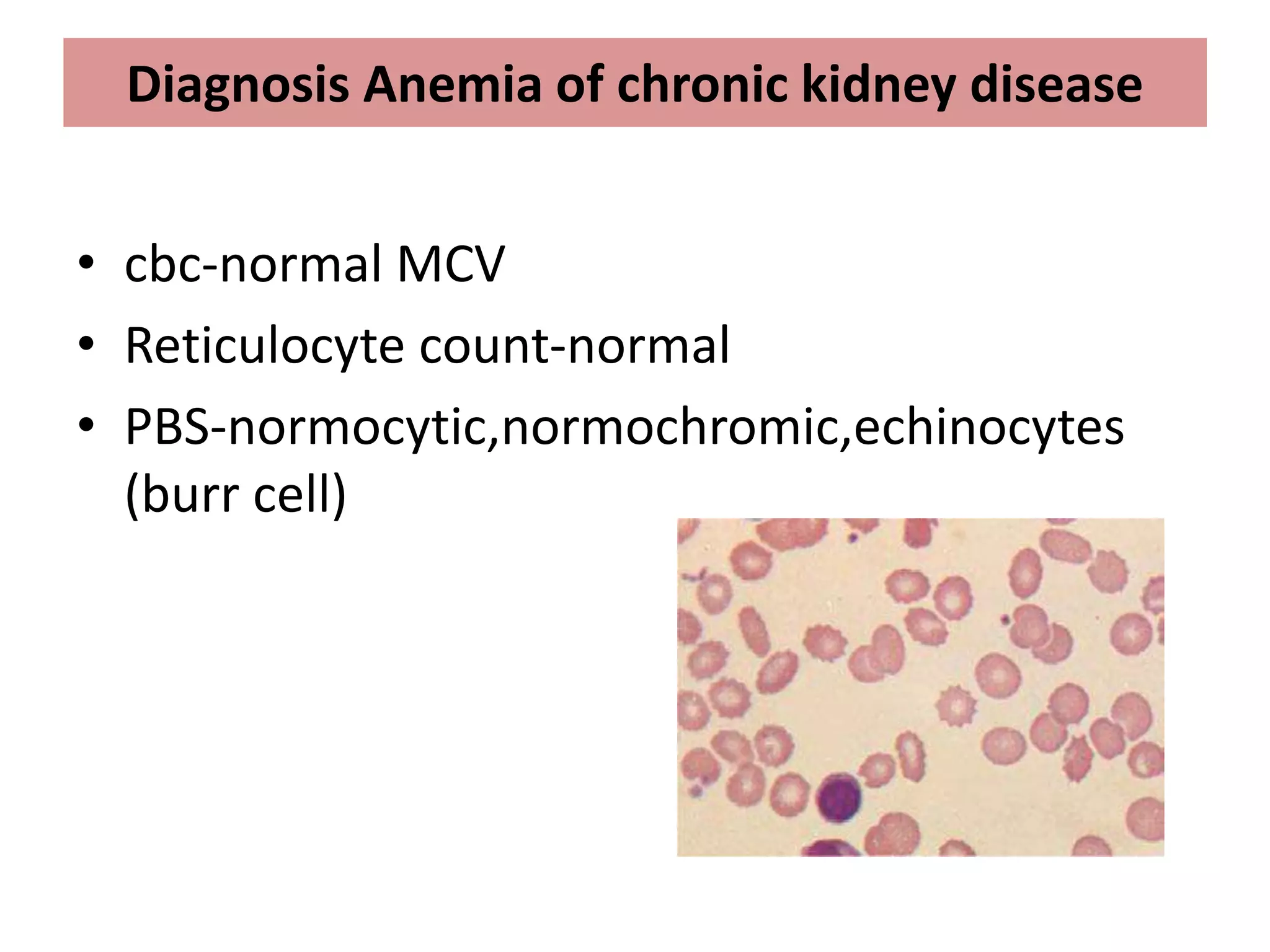 Diagnosis of Anemia | PPTX