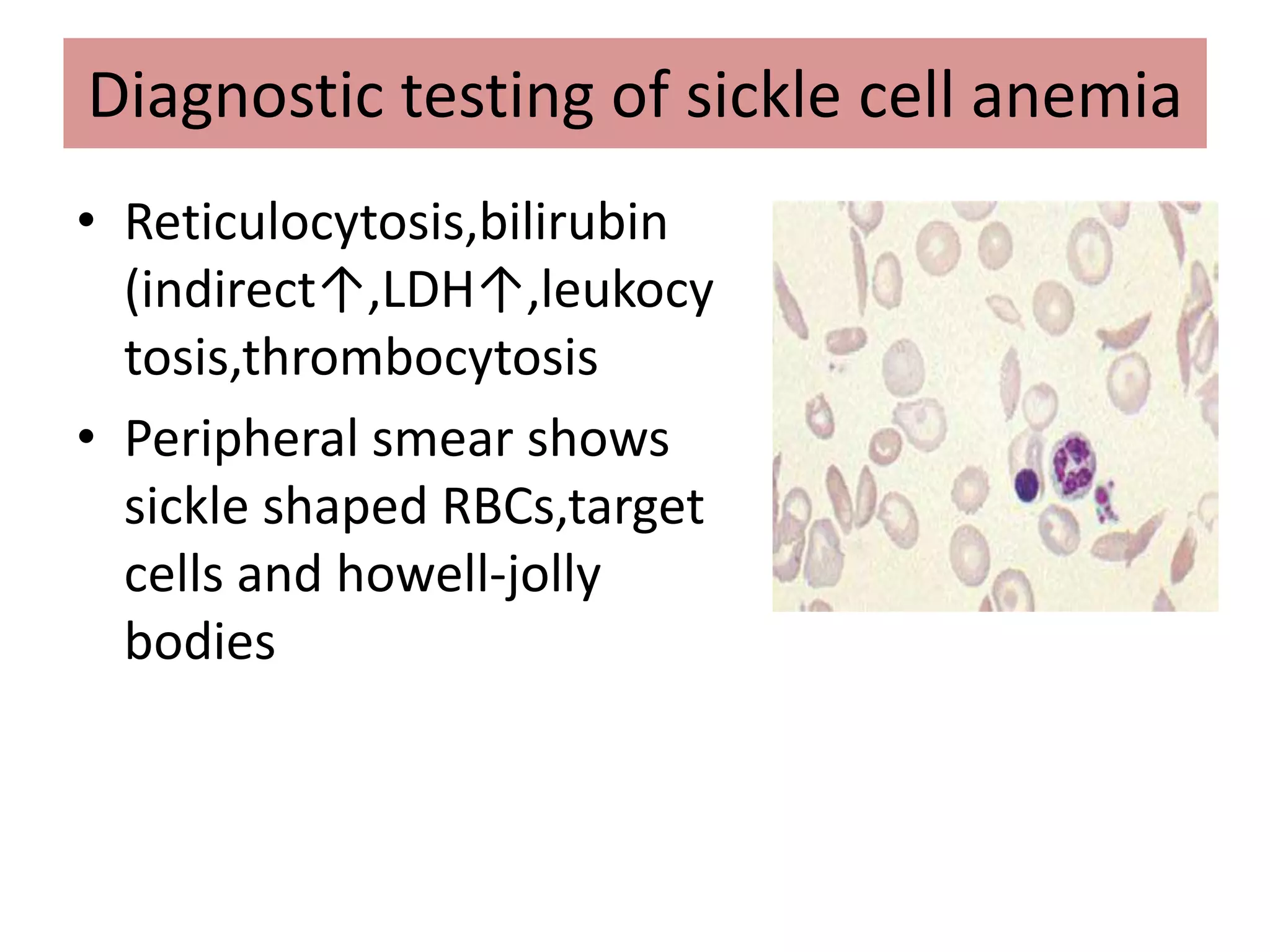 Diagnosis of Anemia | PPTX