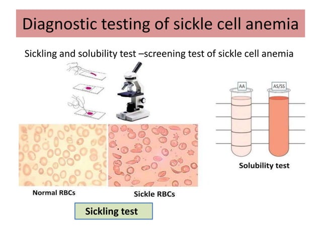 Diagnosis of Anemia | PPTX