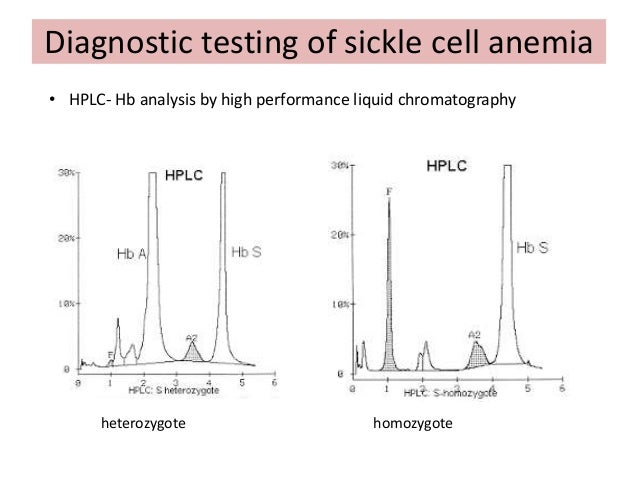 Diagnosis of Anemia
