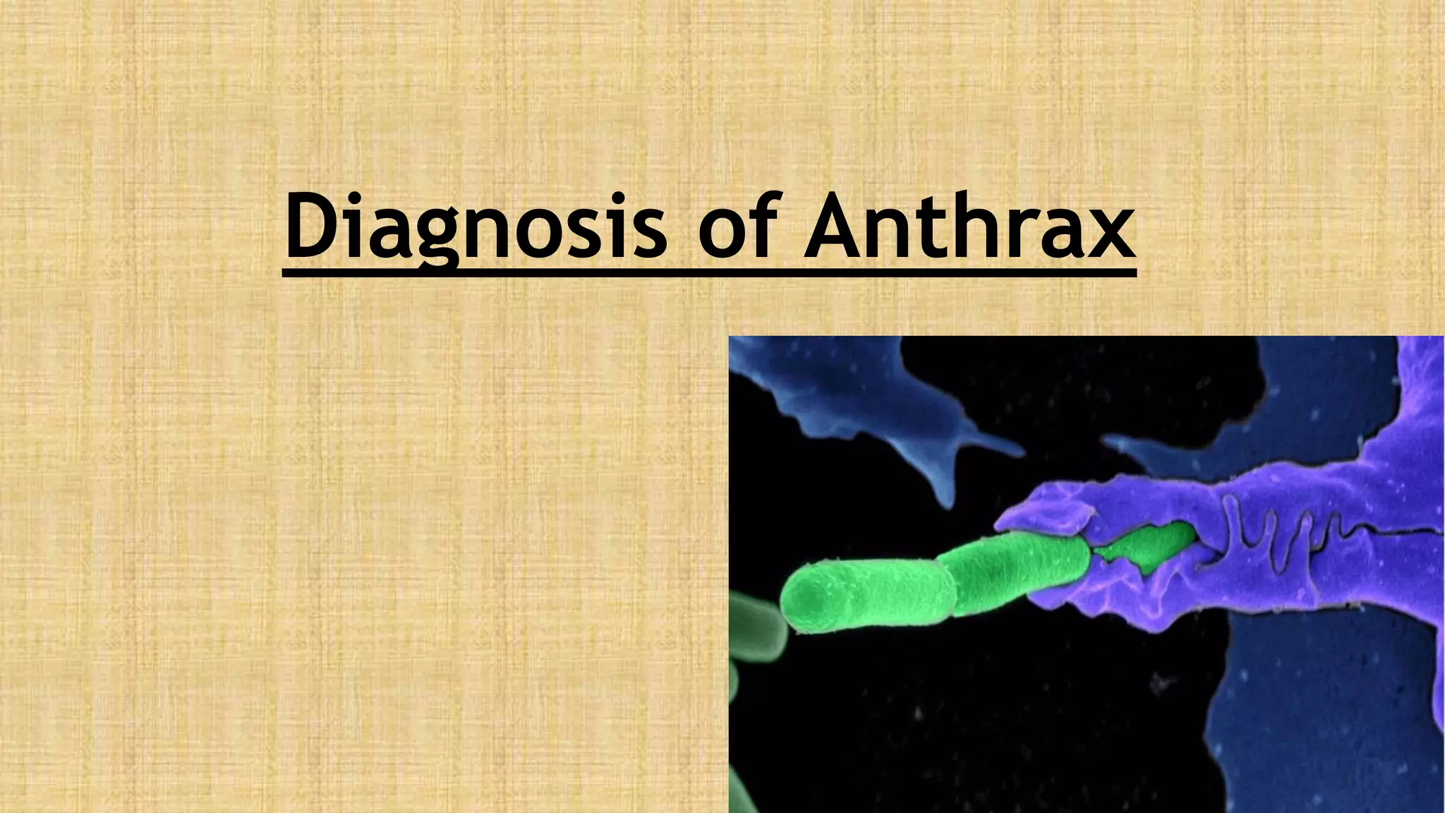Diagnosis of anthrax | PPTX