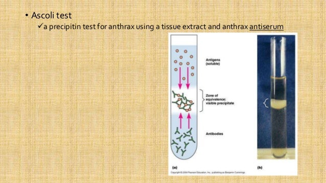 Diagnosis of anthrax
