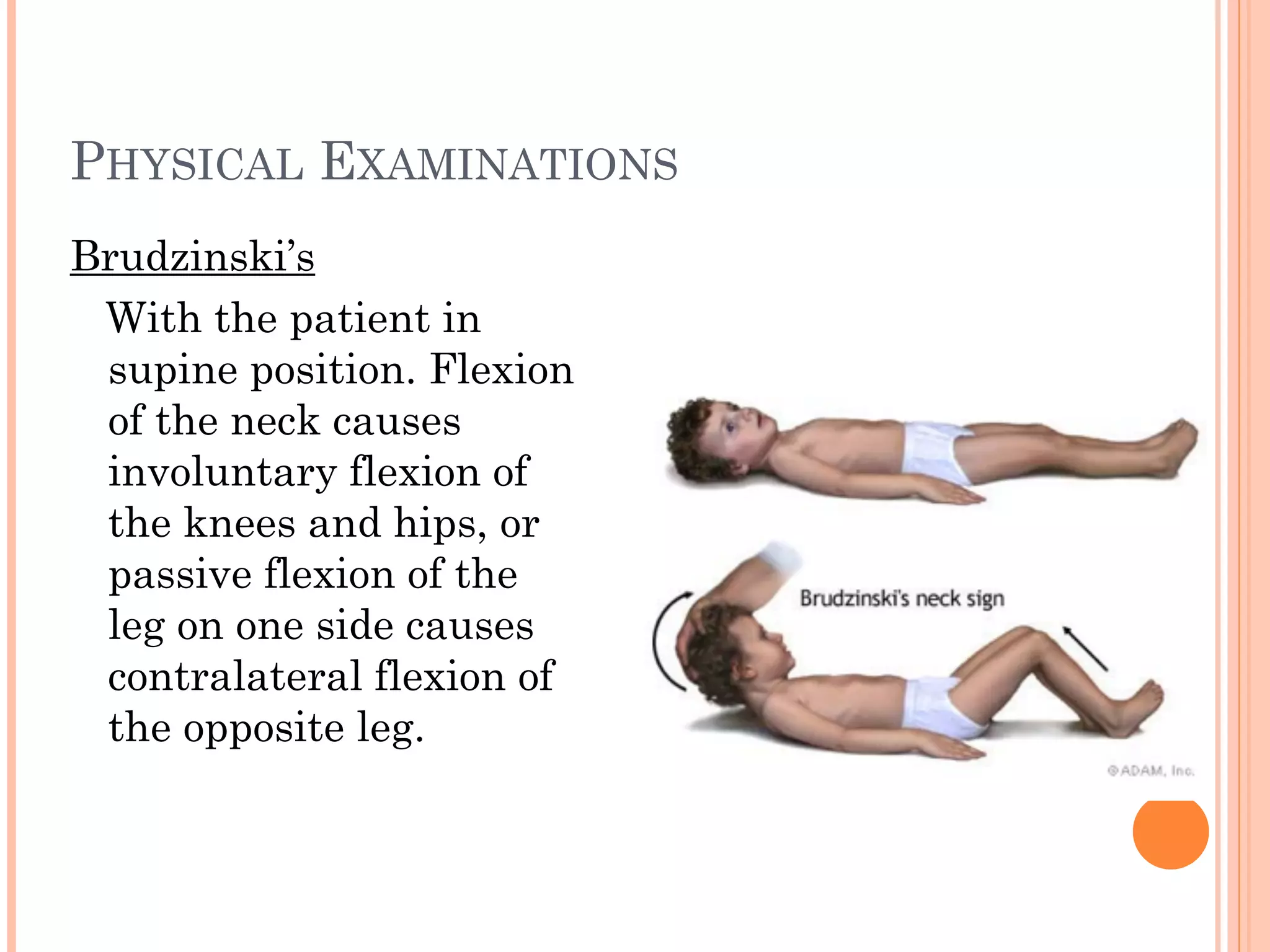 Diagnosis of bacterial meningitis | PDF