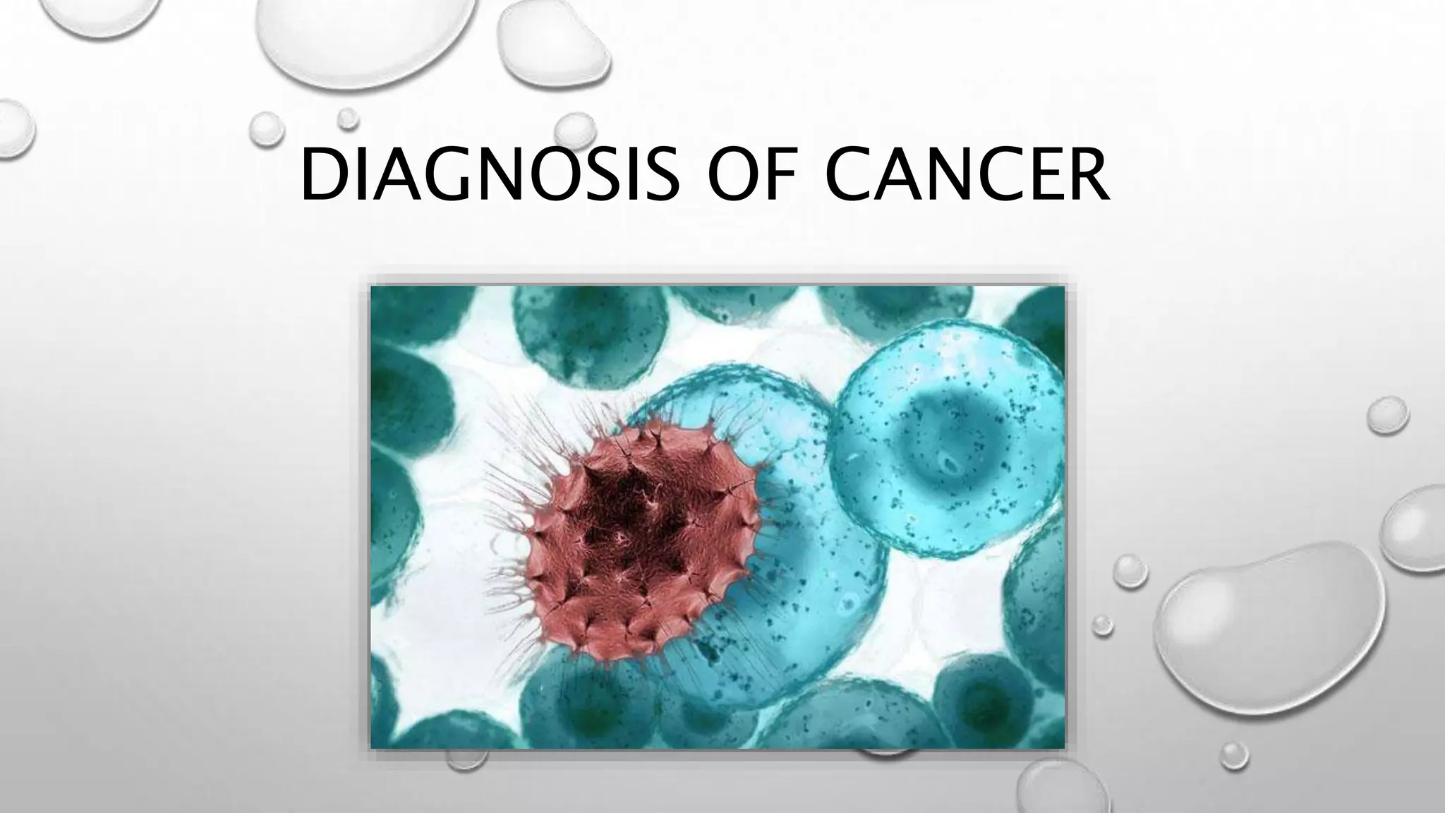 Diagnosis of cancer | PPT