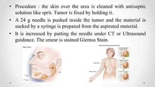 Diagnosis of cancer | PDF