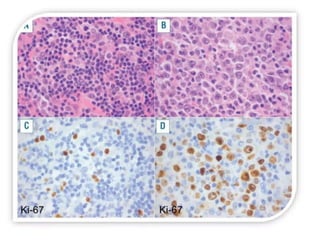 diagnosis of cancer.pptxDiagnosis of cancer, main methods of cancer ...