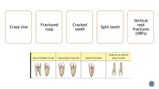 DIAGNOSIS OF CRACKS & FRACTURES in endo.pptx