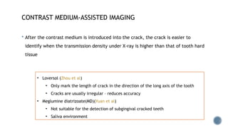 DIAGNOSIS OF CRACKS & FRACTURES in endo.pptx