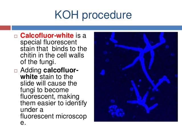 Diagnosis of cutaneous fungal infections