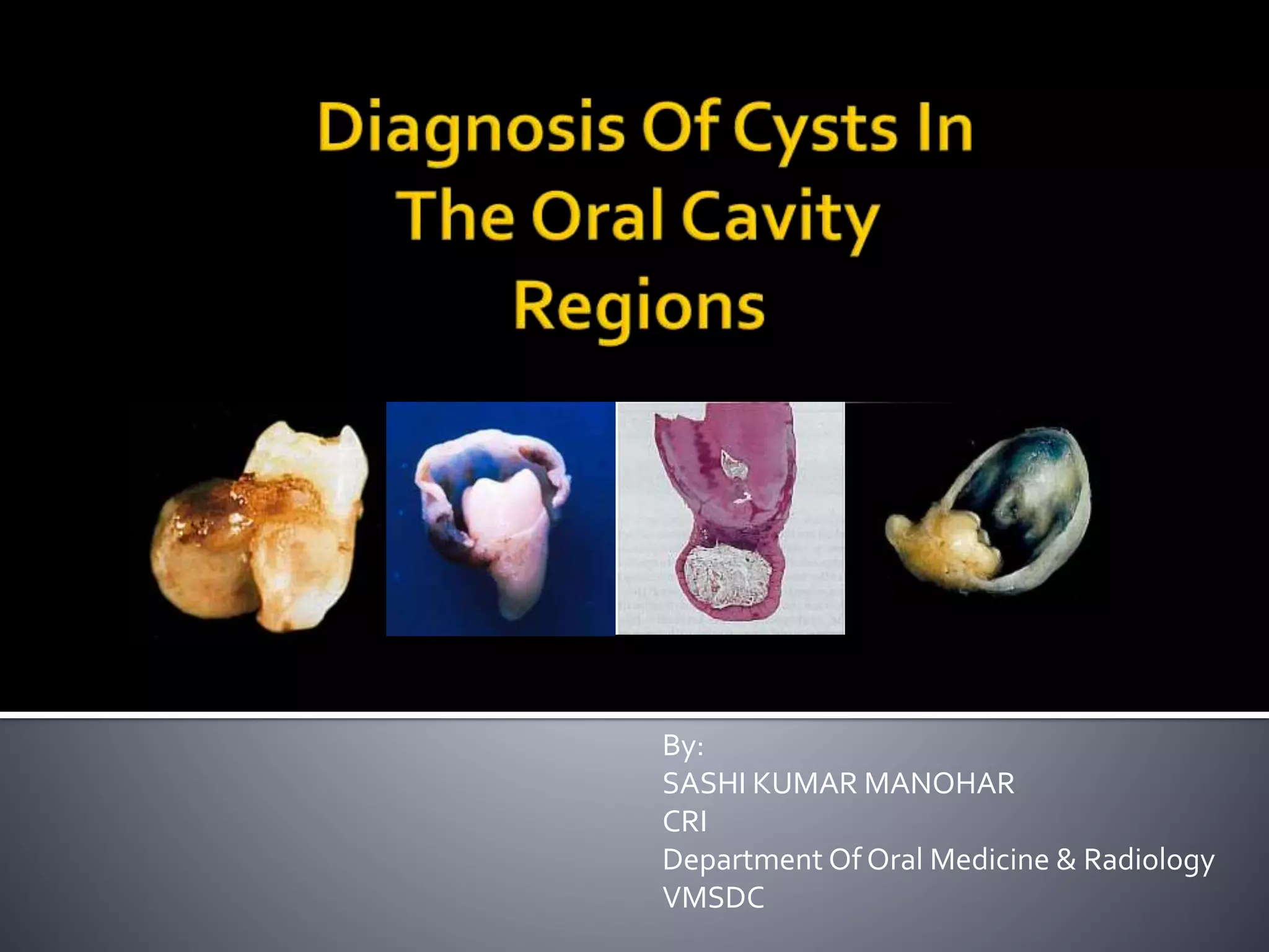 Diagnosis of cysts in oral cavity | PPTX | Dental Health | Diseases and ...