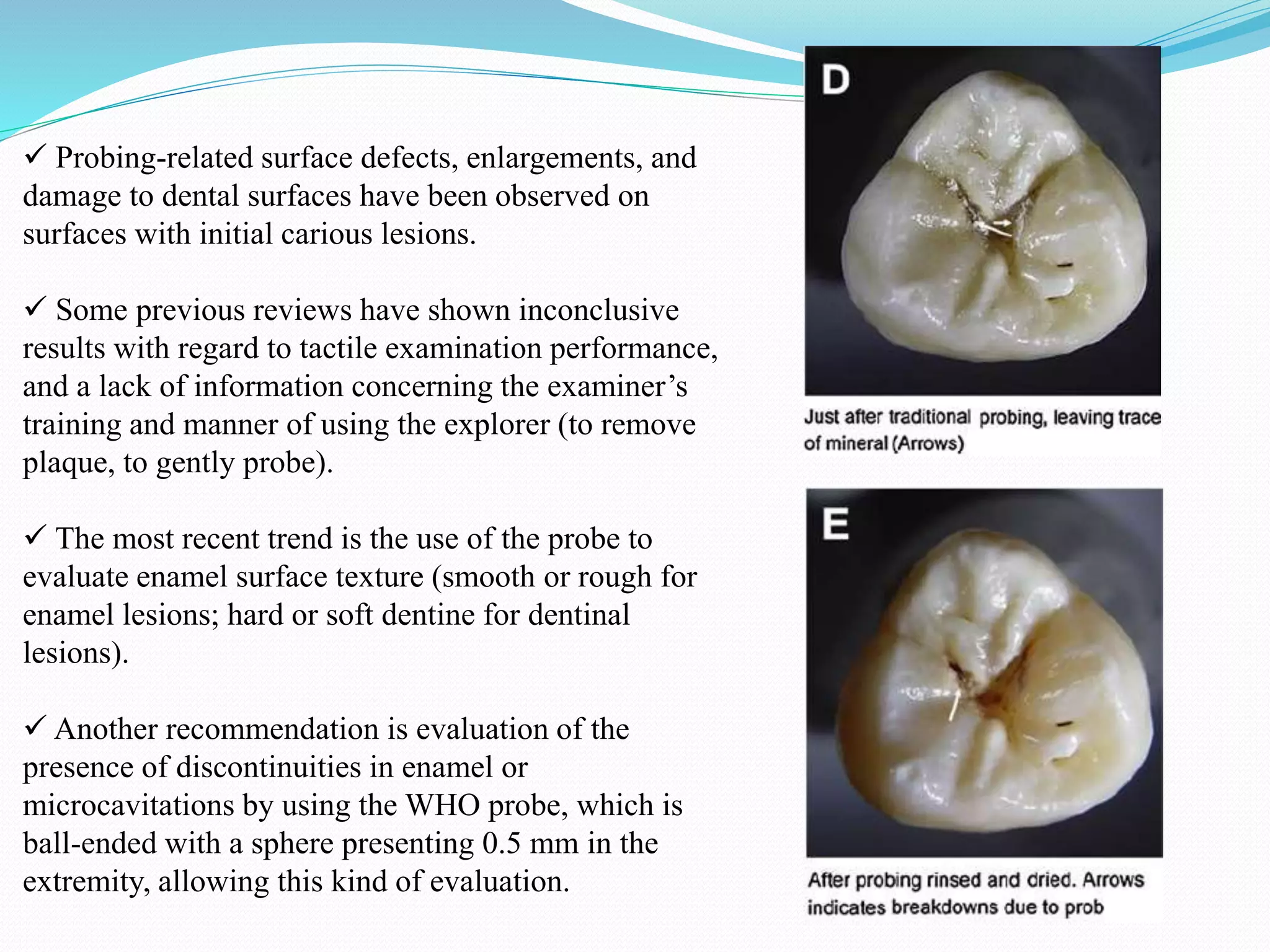 Diagnosis of dental caries | PPTX