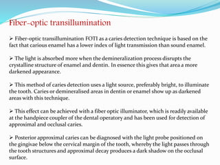 Diagnosis of dental caries | PPT