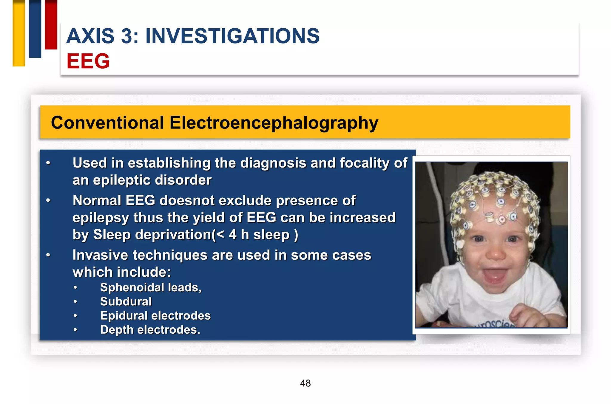 Diagnosis Of Epilepsy Pdf
