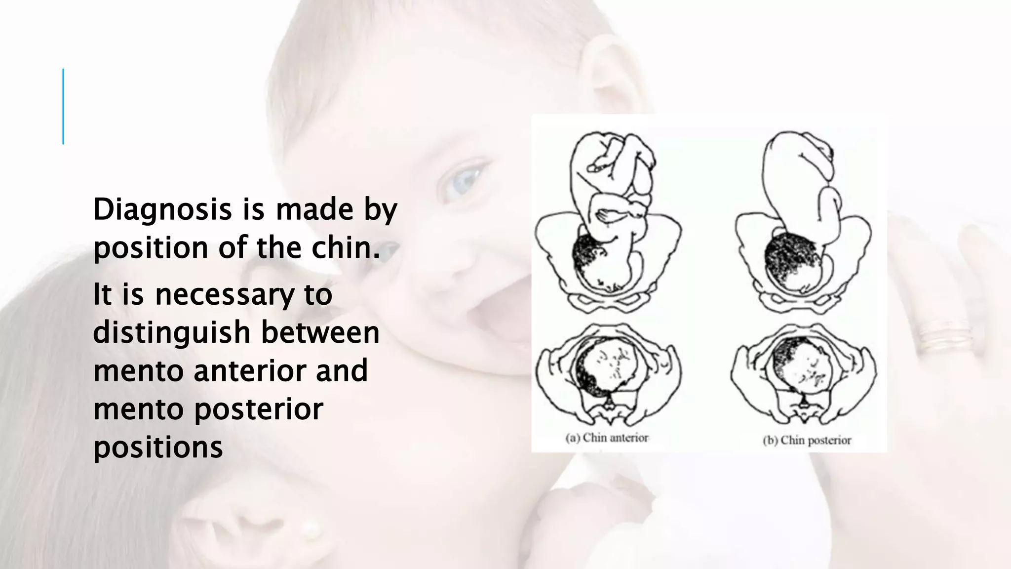 Diagnosis of face presentation | PPTX