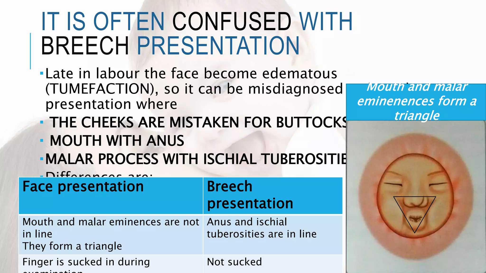 Diagnosis of face presentation | PPTX