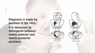 Diagnosis of face presentation | PPTX