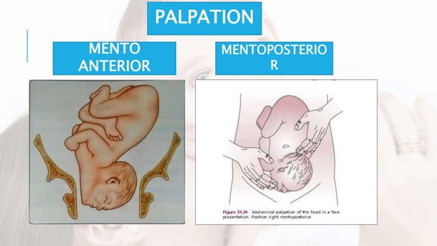 Diagnosis of face presentation | PPTX | Pregnancy | Reproductive Health