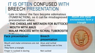 Diagnosis of face presentation | PPTX