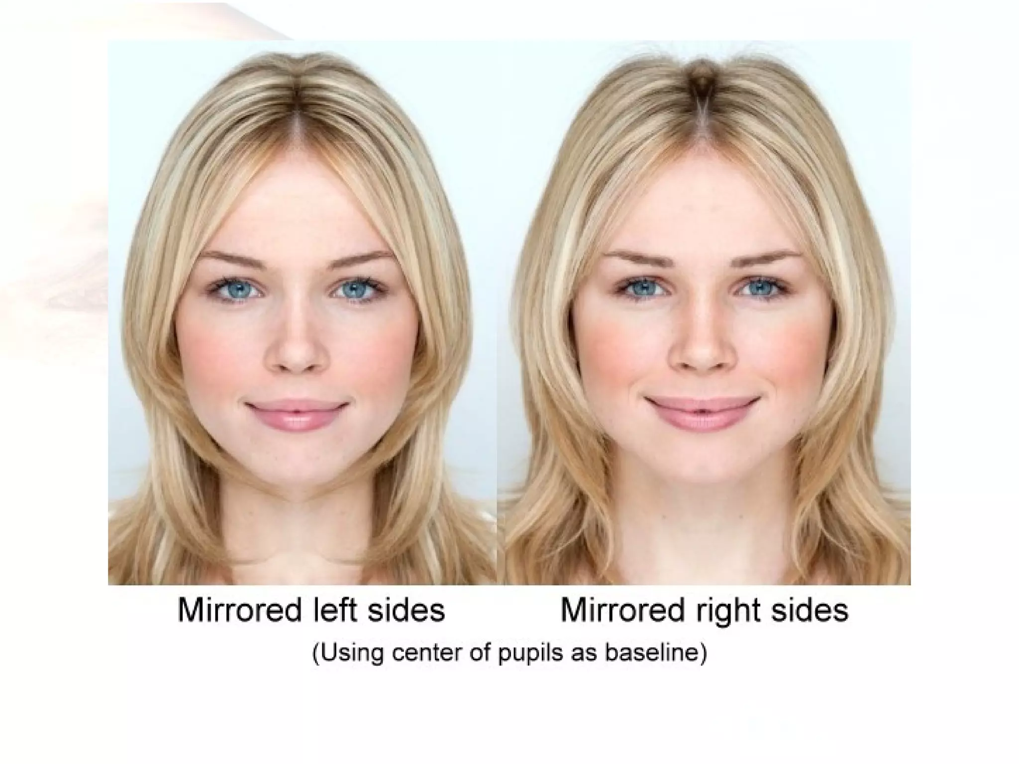 Diagnosis of facial asymmetry bakri | PPT