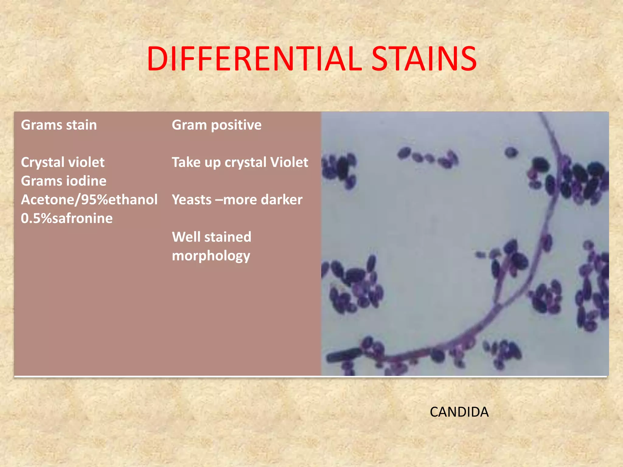 Lab diagnosis of fungal infections, Dr Naveen Reddy | PPTX