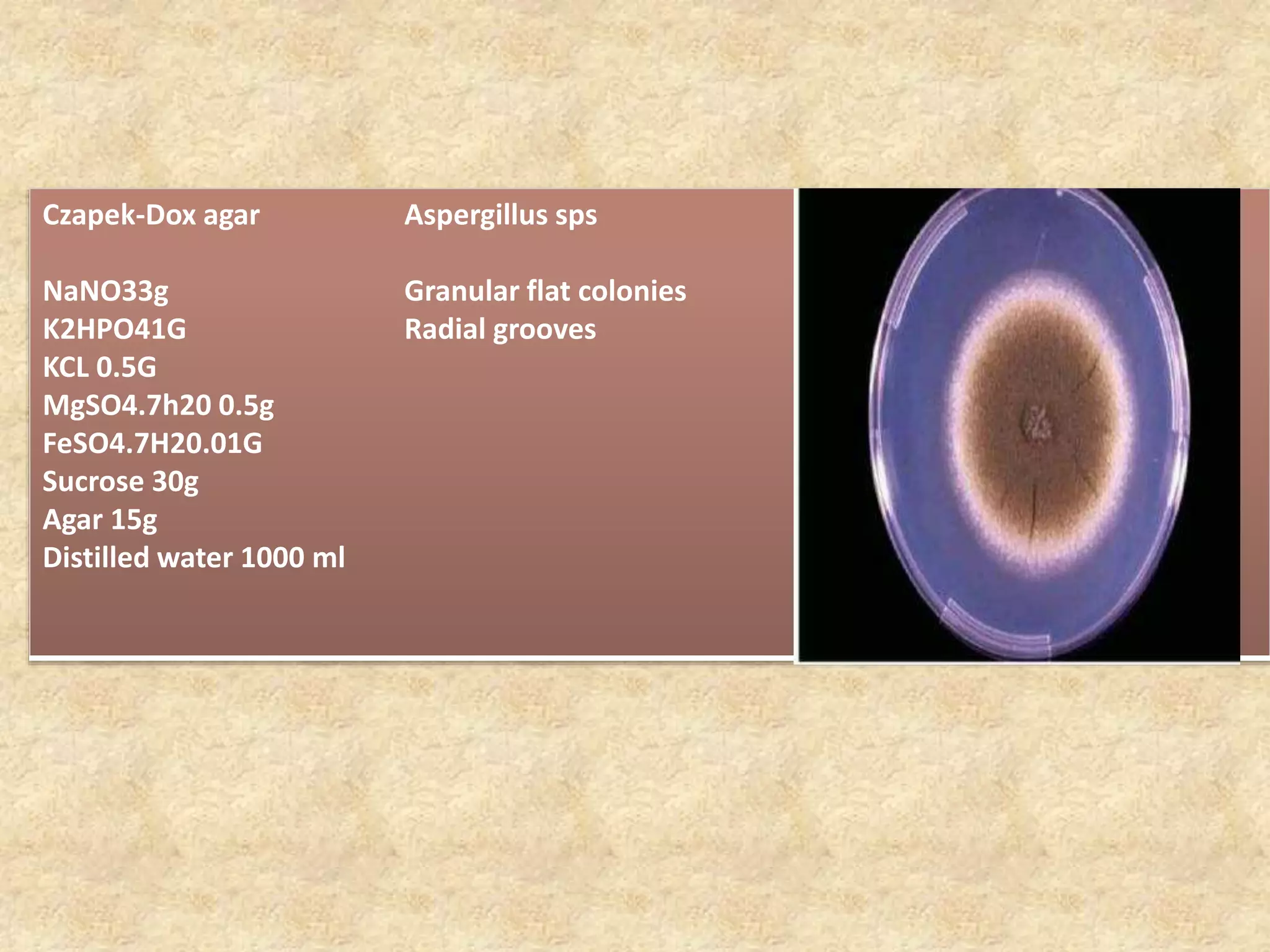 Lab diagnosis of fungal infections, Dr Naveen Reddy | PPTX
