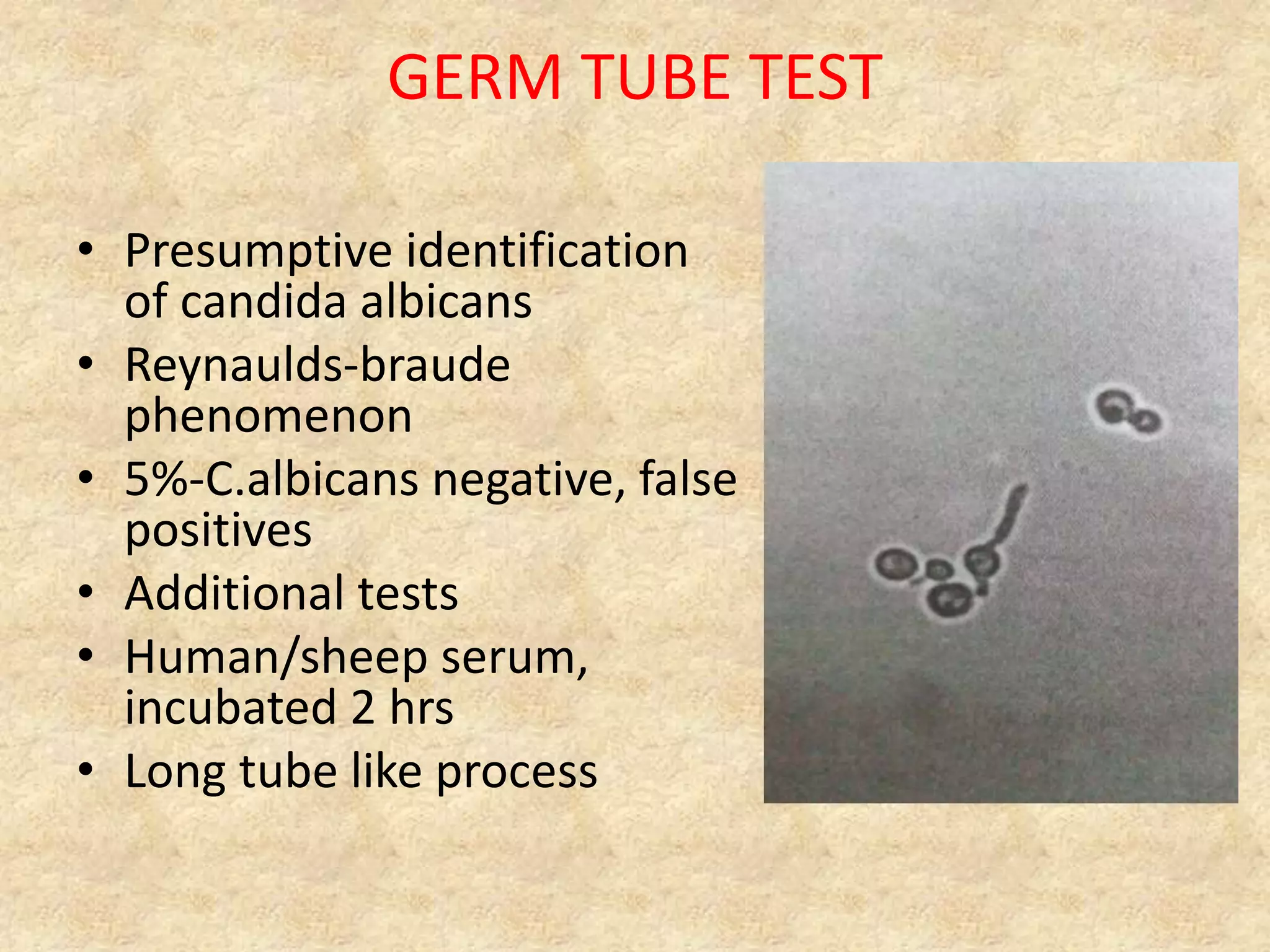 Lab diagnosis of fungal infections, Dr Naveen Reddy | PPTX