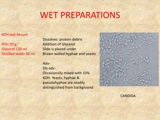 Lab diagnosis of fungal infections, Dr Naveen Reddy | PPTX