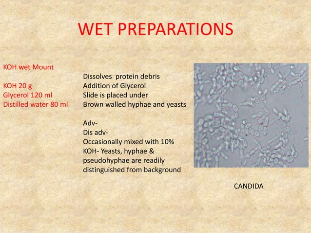 Lab diagnosis of fungal infections, Dr Naveen Reddy | PPTX
