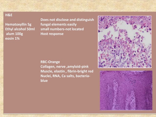 Lab diagnosis of fungal infections, Dr Naveen Reddy | PPTX