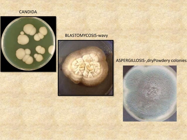 Lab diagnosis of fungal infections, Dr Naveen Reddy | PPTX