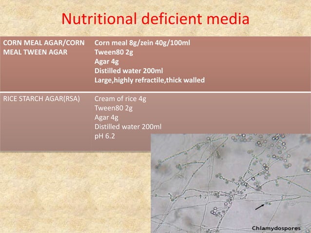 Lab diagnosis of fungal infections, Dr Naveen Reddy | PPTX