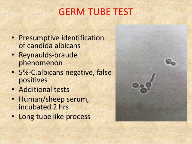 Lab diagnosis of fungal infections, Dr Naveen Reddy