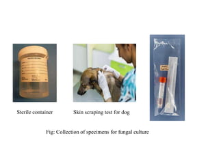 Diagnosis of fungal disease by Dr. Manoj karki | PPT