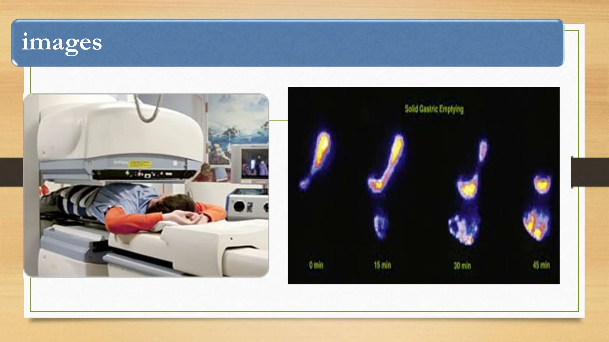 Diagnosis of Gastrointestinal Track.pptx