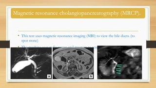 Diagnosis of Gastrointestinal Track.pptx