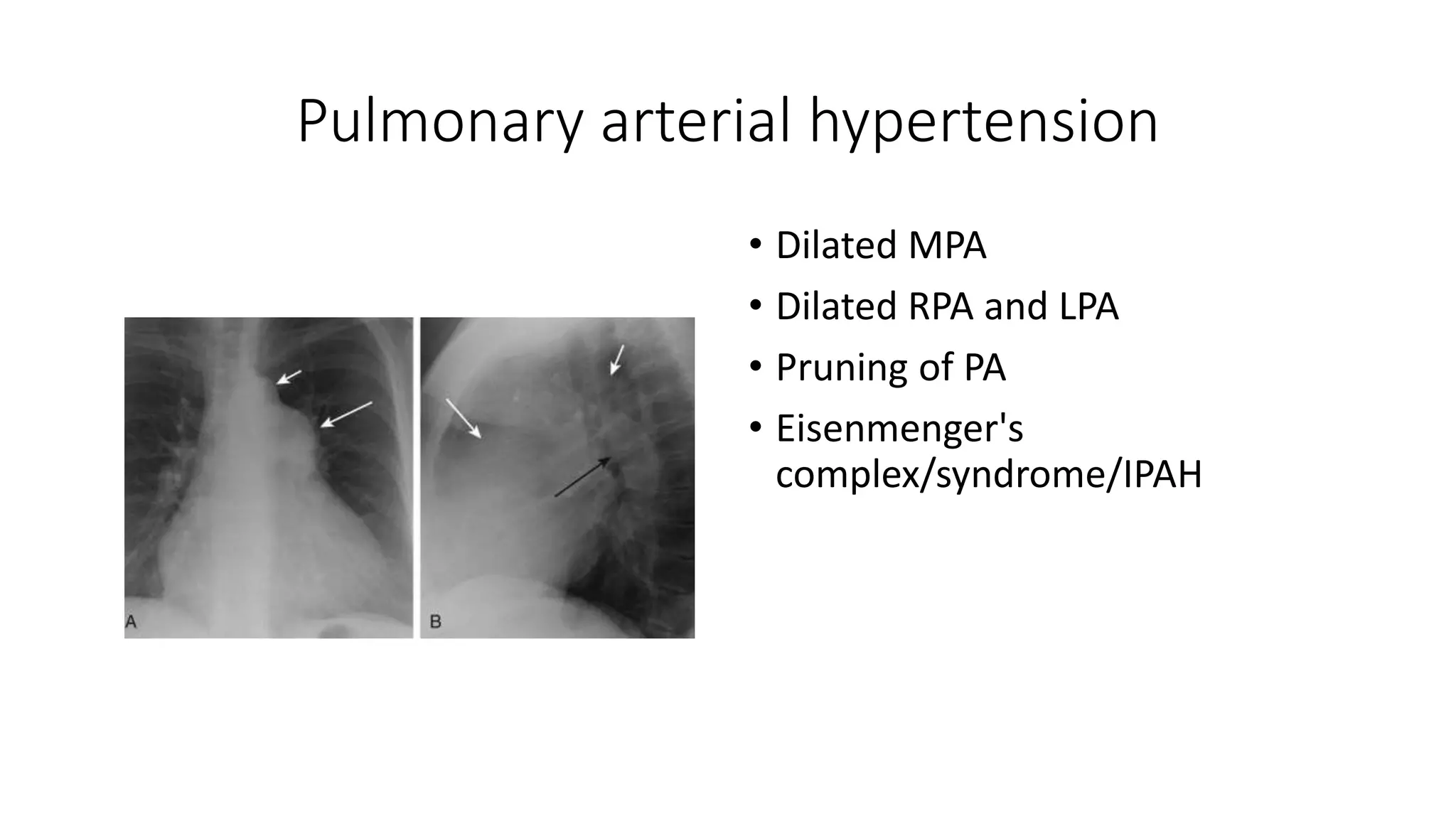 Diagnosis of heart diseases from chest x ray | PPTX