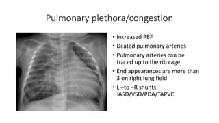 Diagnosis of heart diseases from chest x ray | PPTX